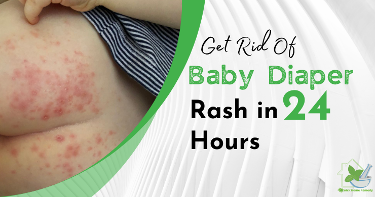 How To Get Rid Of A Baby Diaper Rash In 24 Hours – Quickhomeremedy